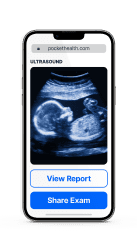 Fetal Biometry: What is BPD on an Ultrasound?