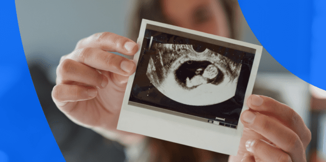 Fetal Biometry: What is BPD on an Ultrasound?